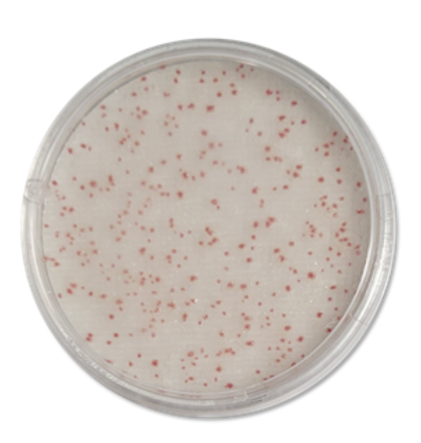 Compact Dry – Advanced Food Diagnostics